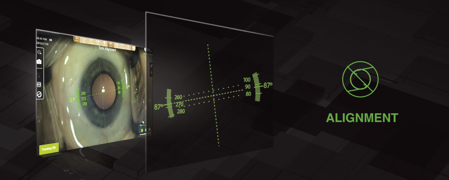 VERION IMAGE GUIDED SYSTEM | 【池袋の眼科-松原クリニック】池袋駅東口徒歩3分